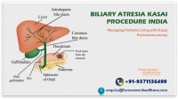 Biliary Atresia Kasai Procedure India Managing Patients Living with Kasai Portoenterostomy