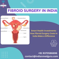 Smart Health Investments: How Fibroid Surgery Costs in India Make a ...